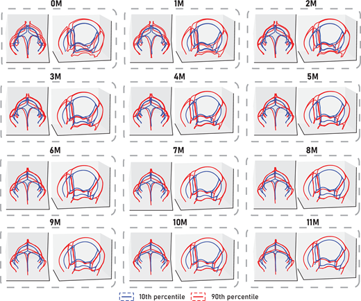 Growth charts of sutures and fontanelles for the first year of infancy ...