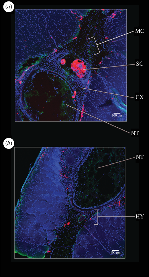 Molecular basis of urostyle development in frogs: genes and gene ...