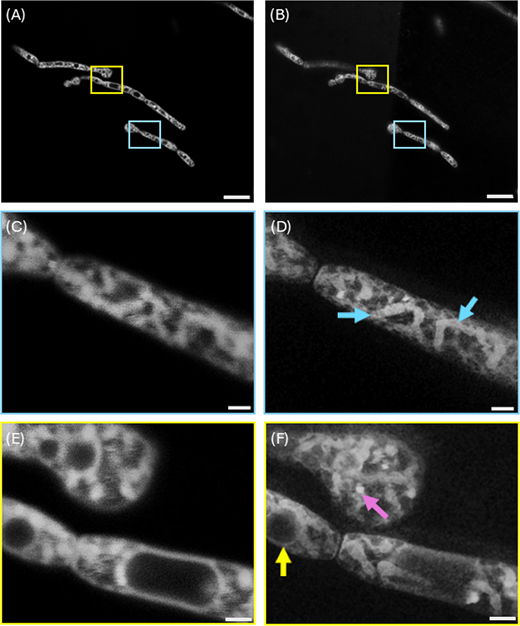 Revealing the ultrastructure of live Candida albicans using stimulated ...