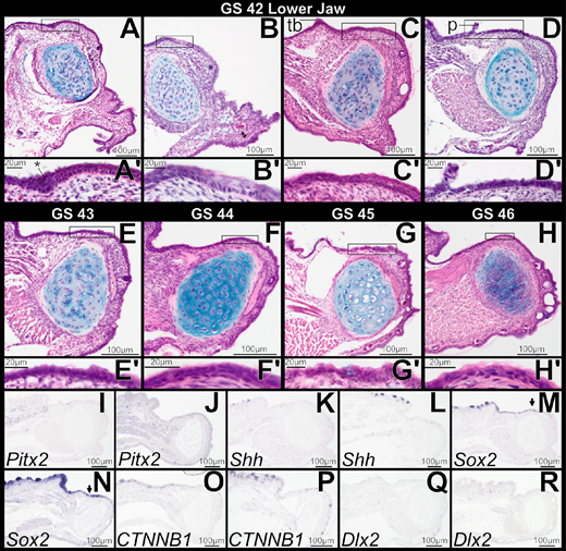 The metamorphic transition of the frog mouth: from tadpole keratinized ...