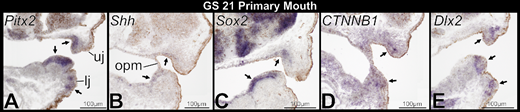 The metamorphic transition of the frog mouth: from tadpole keratinized ...