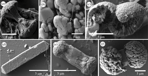 Acorn worm ossicle ultrastructure and composition and the origin of the ...