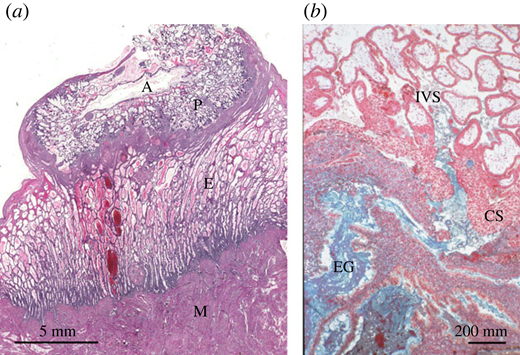 The human placenta: new perspectives on its formation and function ...